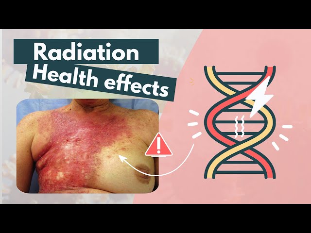 Radiations Impact Unveiling Deterministic And Stochastic Effects