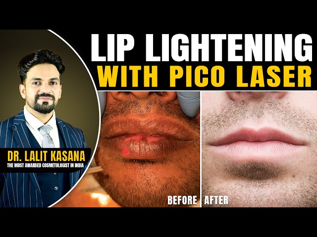 Lip Lightening Treatment A Comprehensive Guide SchoolTube