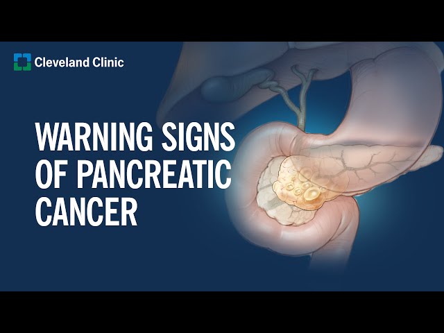 Pancreatic Cancer 6 Warning Signs You Should Know Schooltube